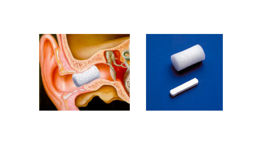 Nasopore, Sinupore och Otopore - Öron, Näsa, Hals - Kebomed